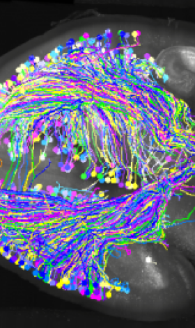 Digital Brain Analytics