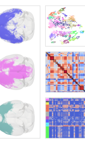 Digital Brain Analytics